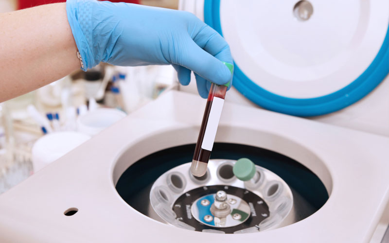 State-of-the-Art Joint Pain Treatment in Columbus, Georgia